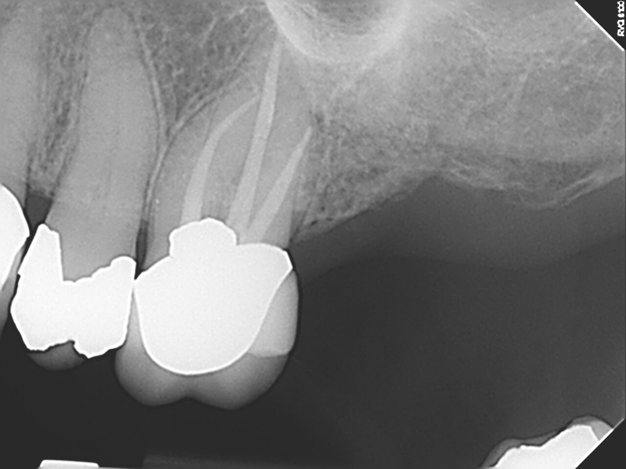 February 2018 - BWs Crucial for Diagnosis - EndoExperience