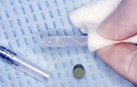 Diagnosis - EndoExperience