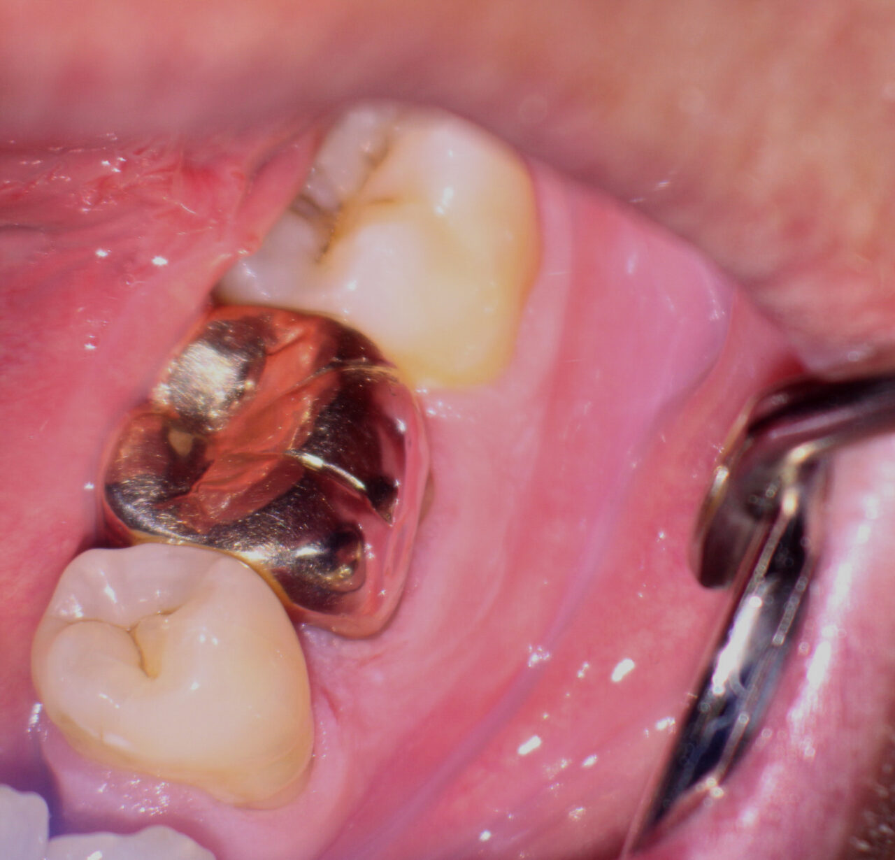 October 2020 - BWs and Communication with the Referral Best Manages the ...