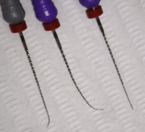 File Bending - An essential skill for Endodontics - EndoExperience
